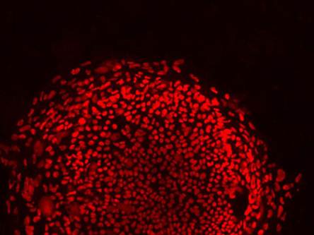 Nature：iPS技术与核移植孰优孰劣？-科研实验中心